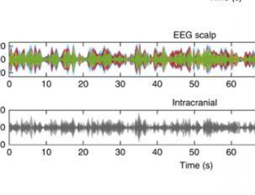 EEG vs MRI vs fMRI vs fNIRS - 长擎科技